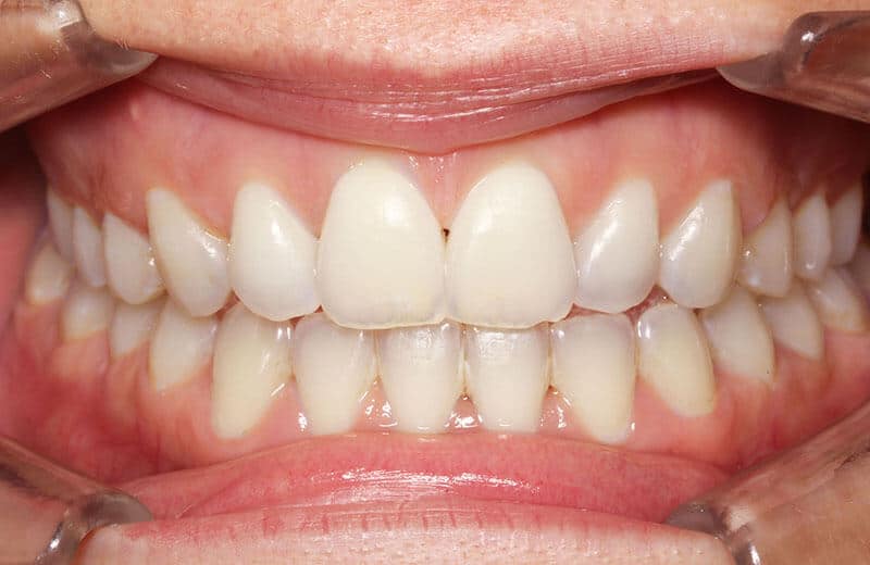 Orthodontiste Paris : Cabinet d’Orthodontie à Paris | Dr Issembert
